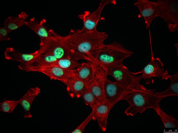 12Z Human Endometrial Epithelial Cell Line | SCC443